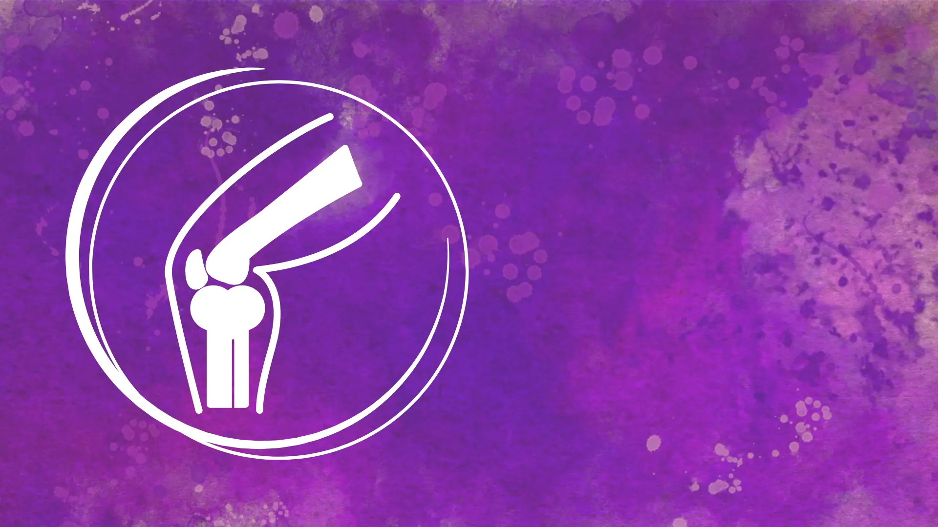 Lupus Essentials - Lupus CME